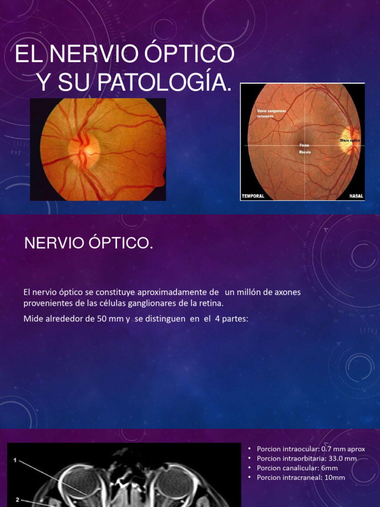 Material de Apoyo Unidad 3 - Nervio Optico | PDF