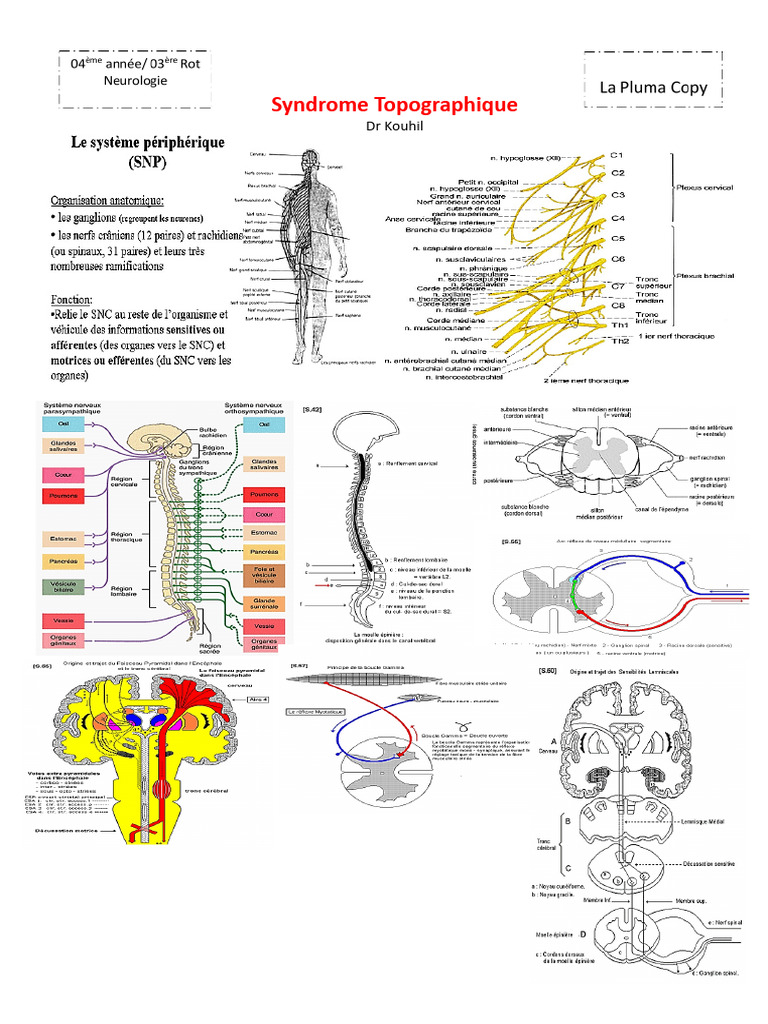 Syndrome Topographique et Radiculaire | PDF