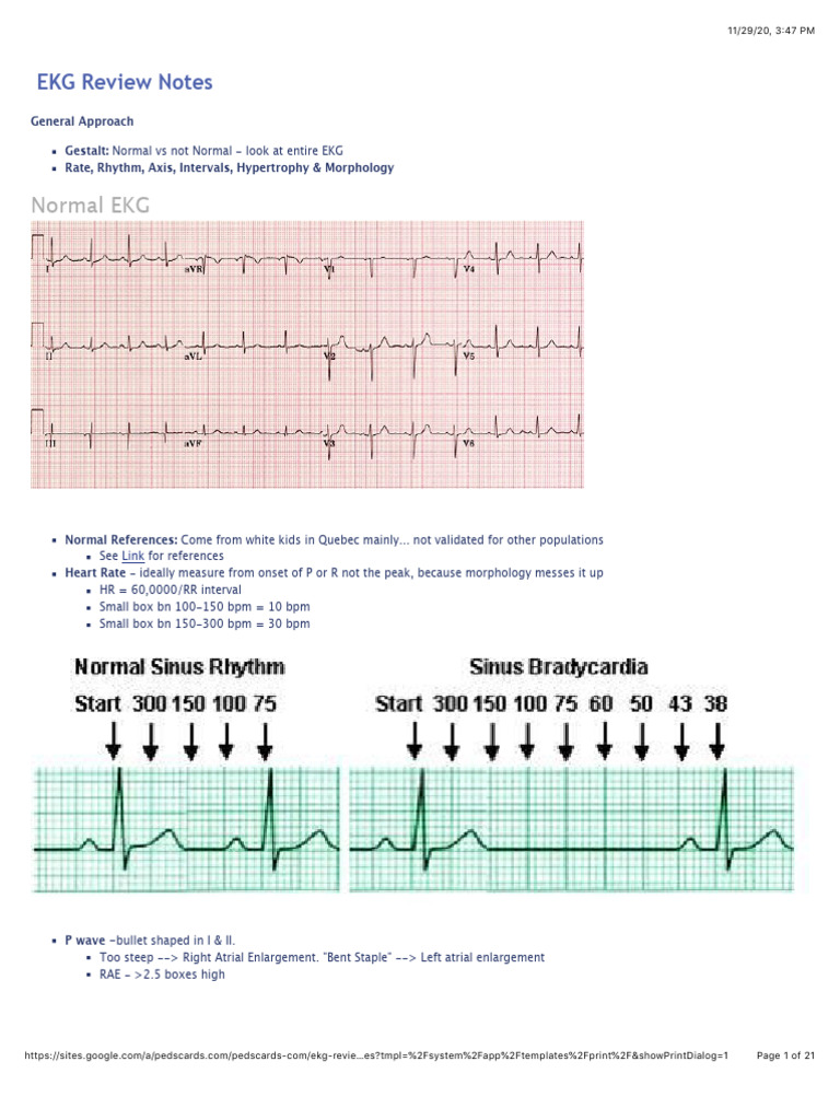 EKG Review Notes | PDF