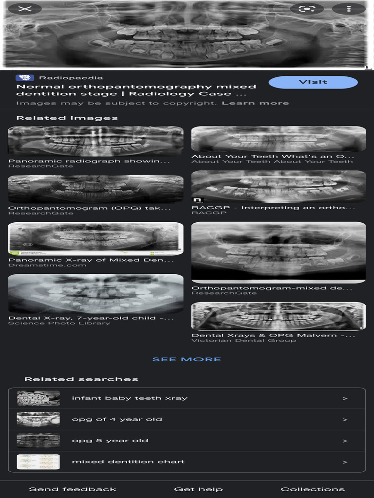 Baby Opg - Google Search | PDF | Language Arts & Discipline | Wellness