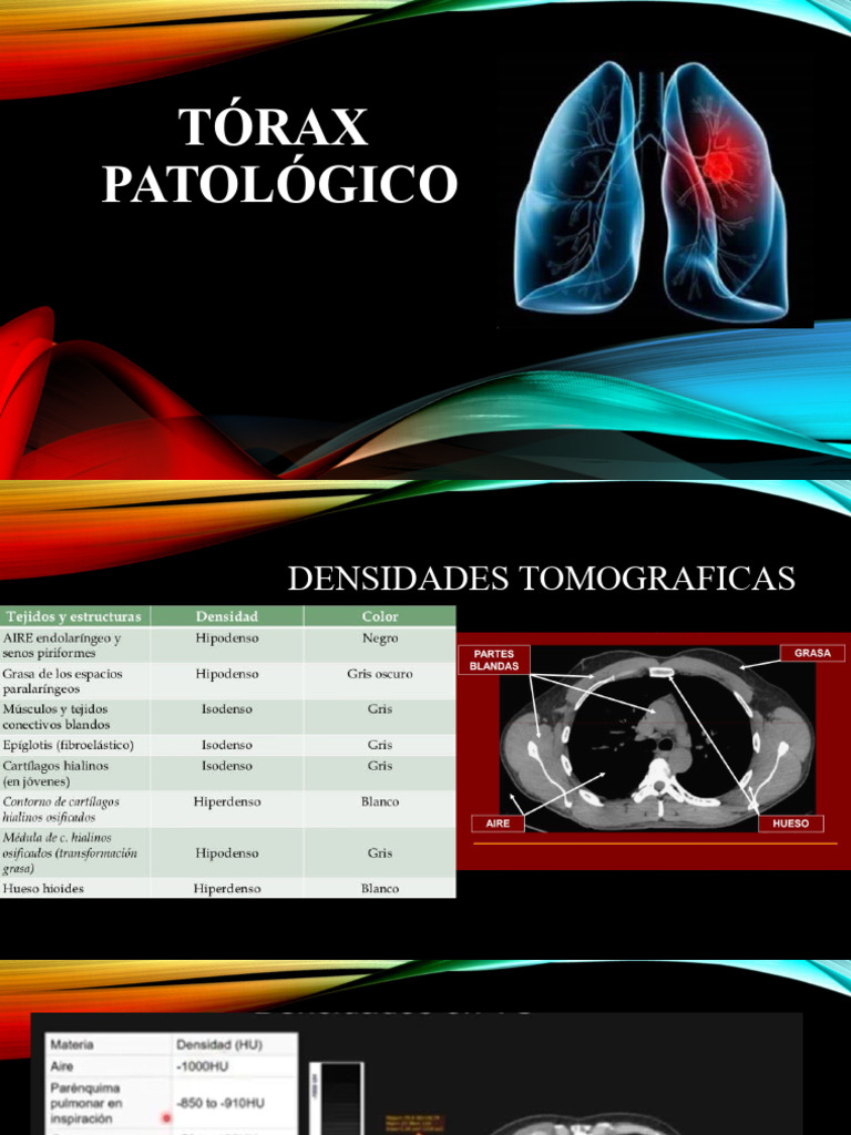 Densidades y Patrones en Tórax Patológico | PDF