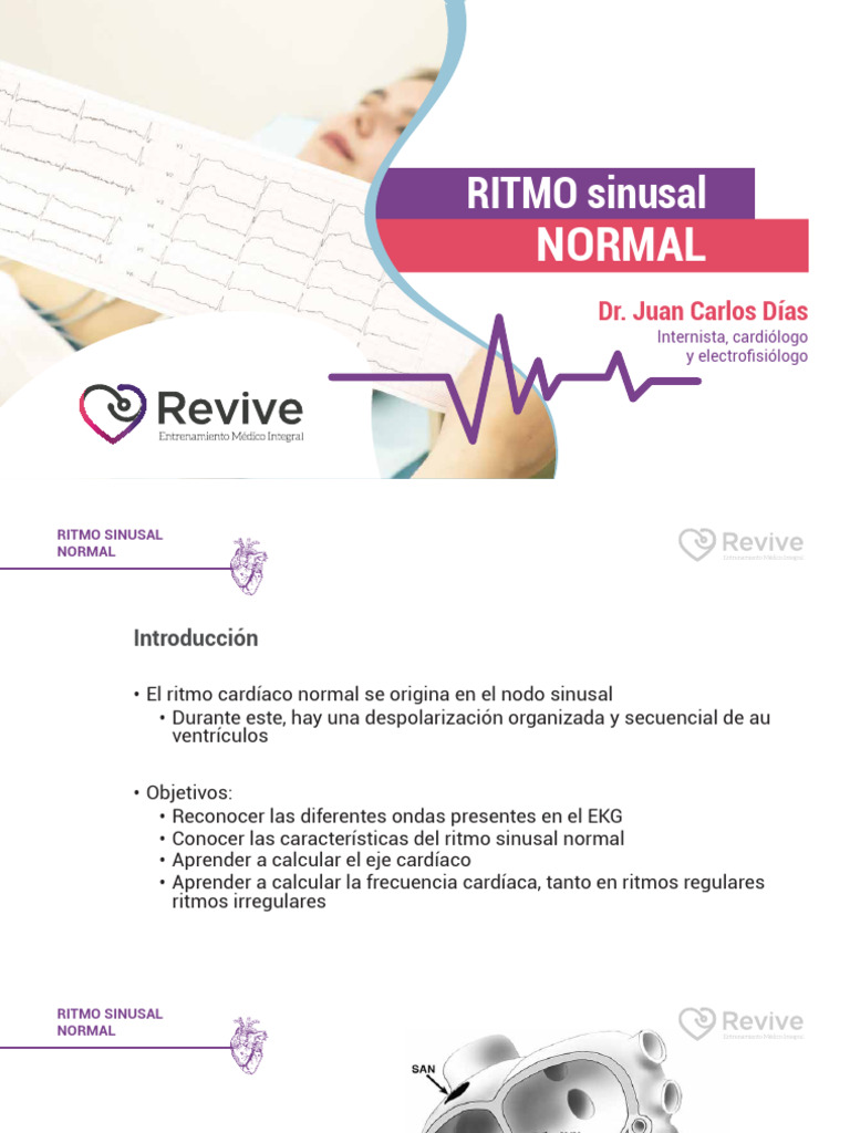 Ritmo Sinusal Normal | PDF