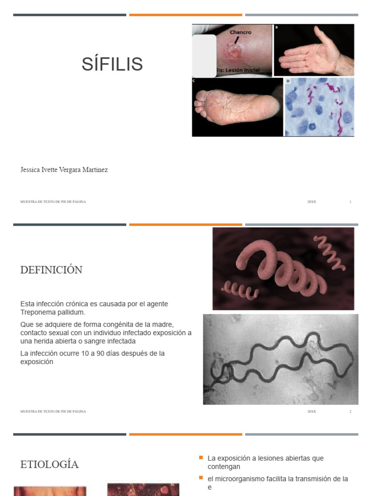 Signos y síntomas de la sífilis | PDF