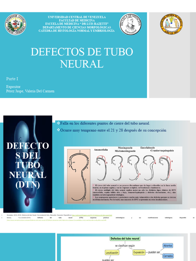 Defectos del Tubo Neural: Clasificación y Tipos | PDF