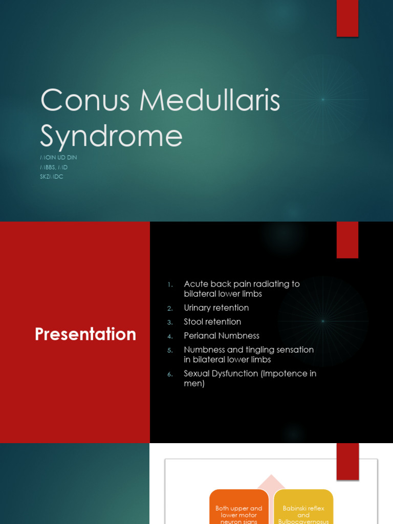 Conus Medullaris Syndrome Presentation | PDF