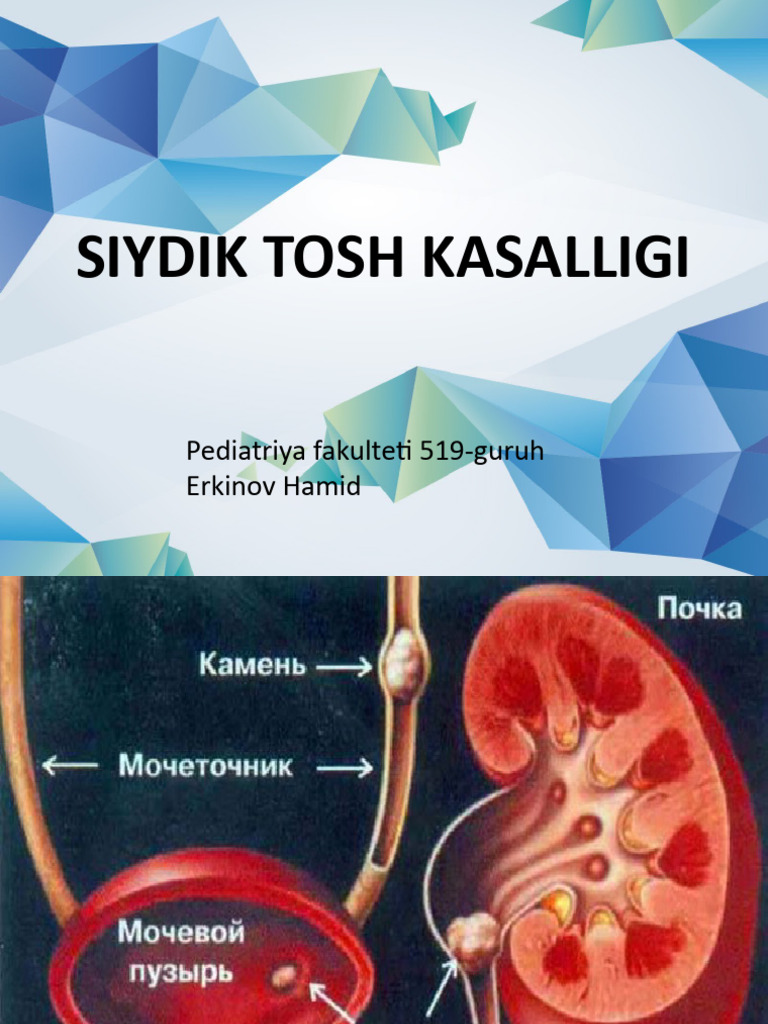 Siydik Tosh Kasalligi | PDF
