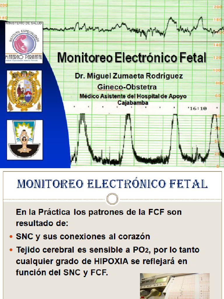 Monitoreo Electrónico Fetal | PDF