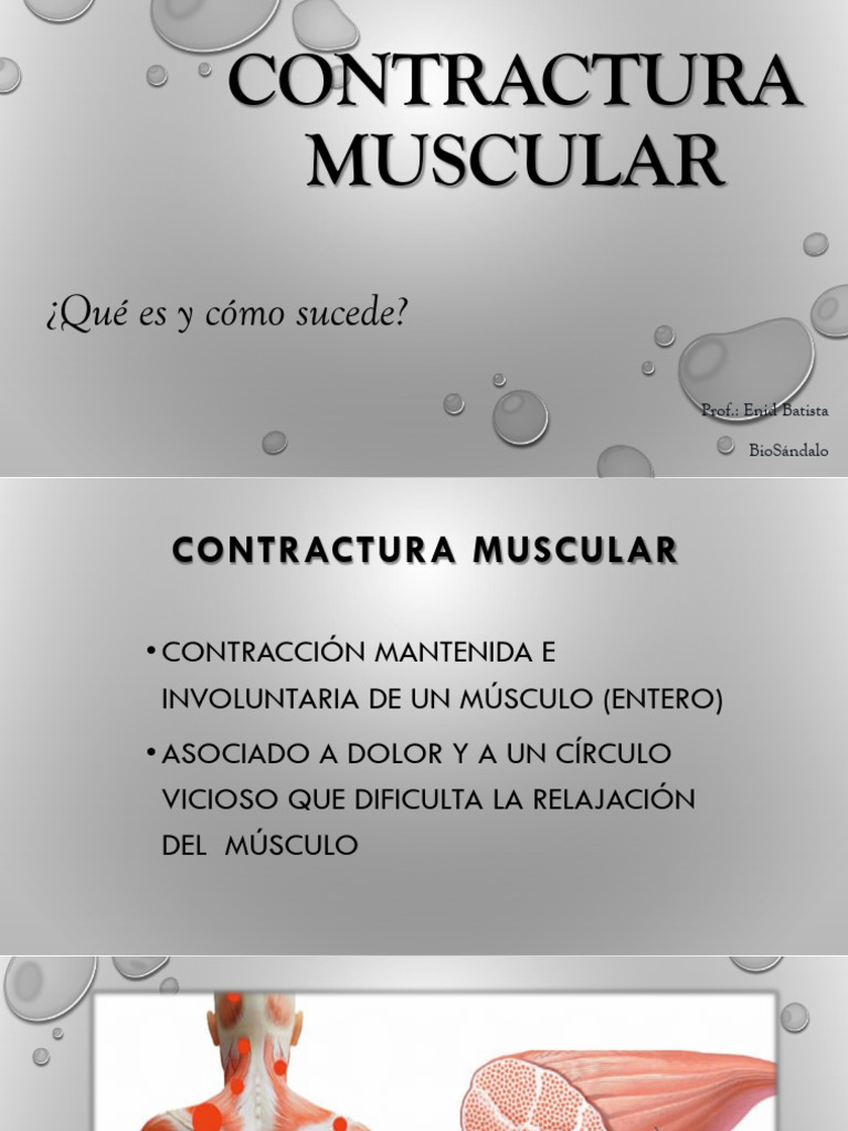 Contractura Muscular - DESCONTRACTURANTE TERAPEUTICO | PDF