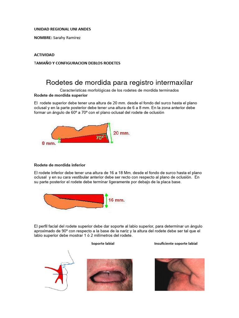 Rodetes de Mordida para Registro Intermaxilar: Tamaño Y Configuracion ...