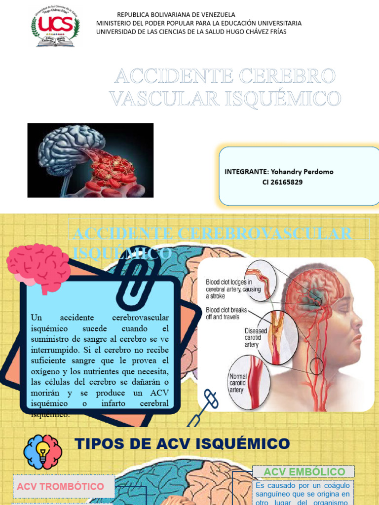 ACV Isquemico 1 | Descargar gratis PDF | Carrera | Isquemia