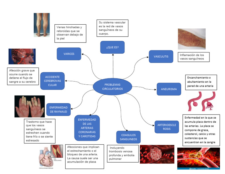 Mapa Mental Problemas Circulatorios | PDF | Trombo | Enfermedades ...