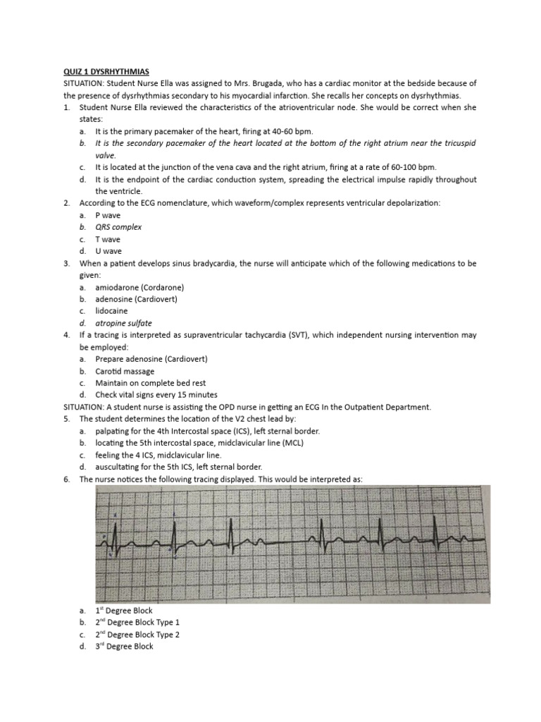 Dysrhythmias Quiz for Nursing Students | PDF