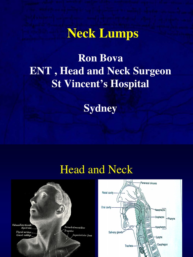 Neck Lumps | PDF