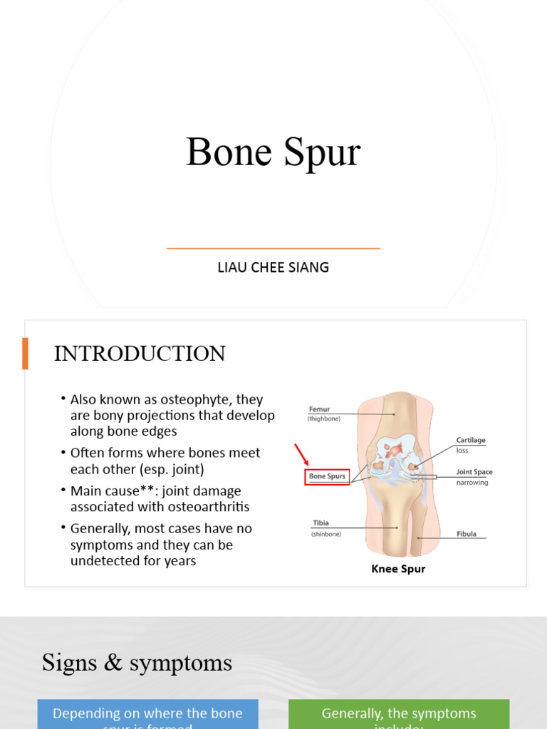 Bone Spur | PDF