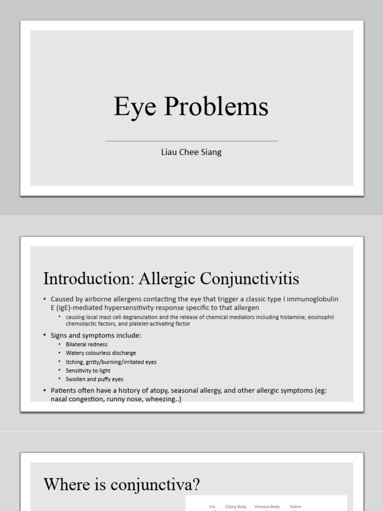 Understanding Allergic Conjunctivitis | PDF