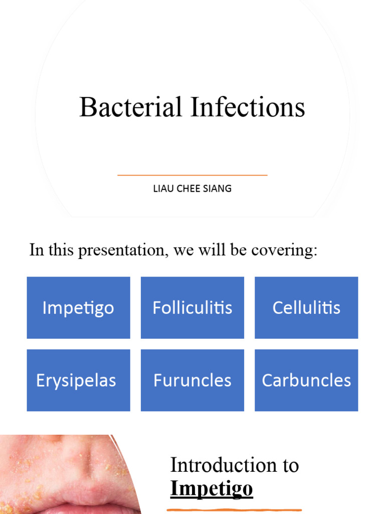 Bacterial Infections | PDF