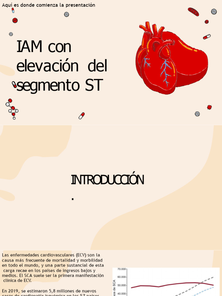 IAM Con Elevación Del ST (1) | PDF | Infarto de miocardio | Isquemia