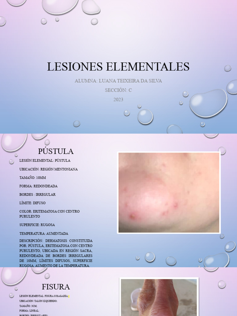 Lesiones Elementales | PDF