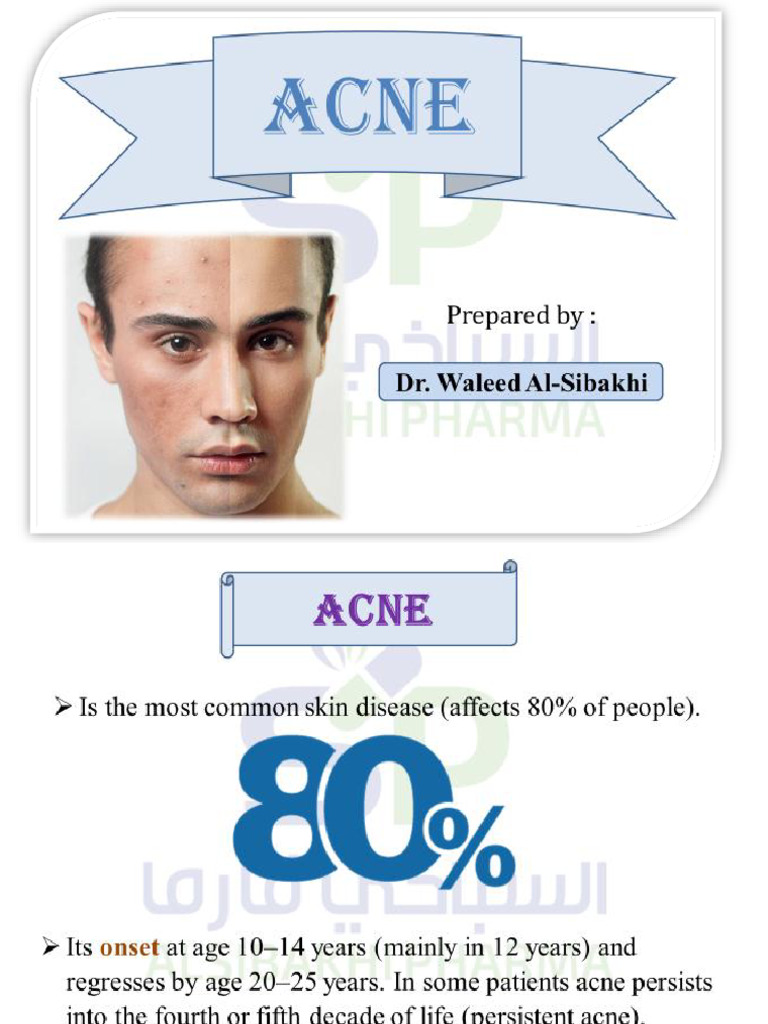 Acne | PDF