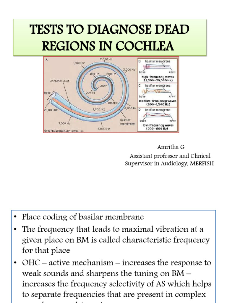 Tests To Diagnose Dead Regions in Cochlea-Ag | PDF | Hearing Loss | Hearing