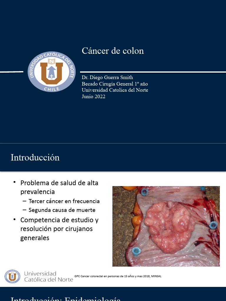 Cancer de Colon | PDF | Cáncer colonrectal | Especialidades Medicas