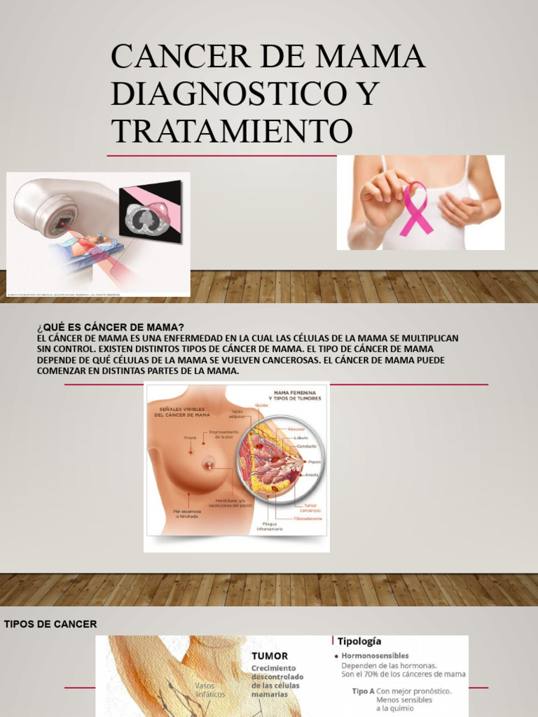 Cancer de Mama Diapositiva | PDF | Cáncer | Cáncer de mama