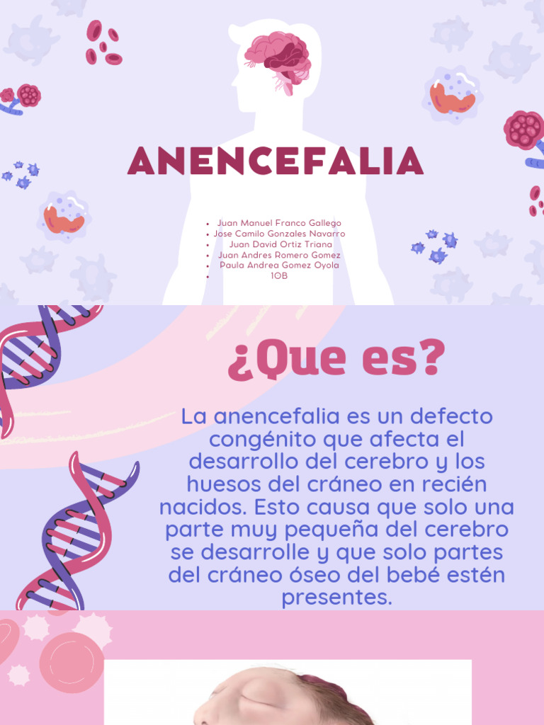 Causas y síntomas de la anencefalia | PDF | El embarazo | Medicina CLINICA