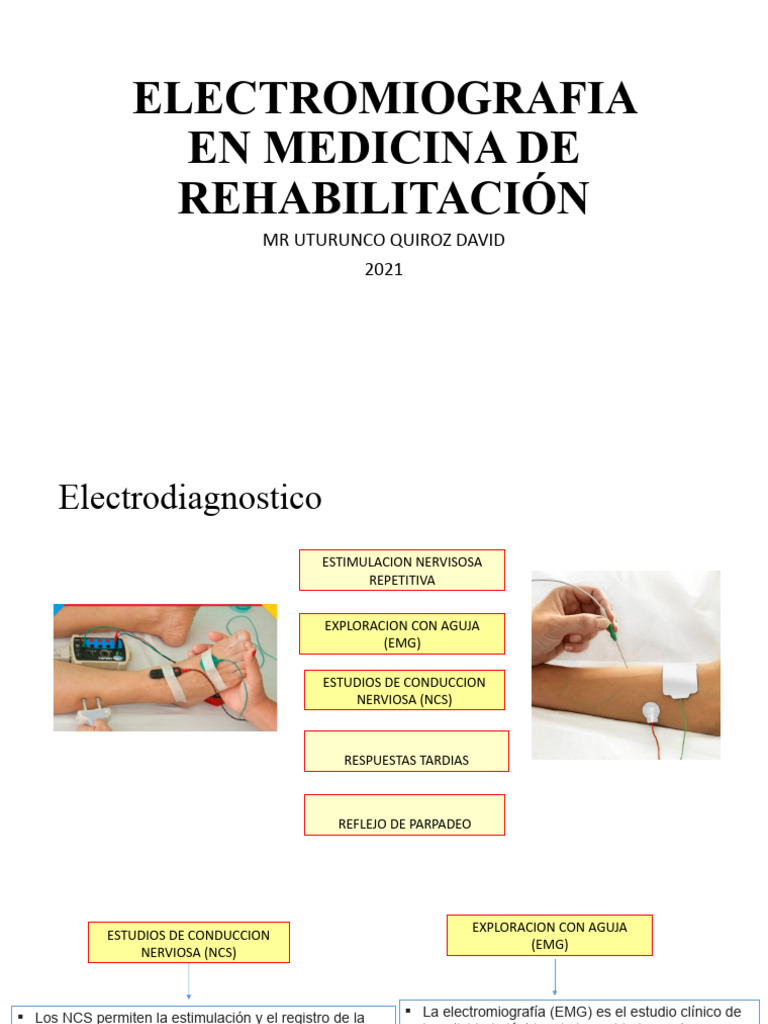 Electromiografia y Vel Conduccion Nerviosa | PDF