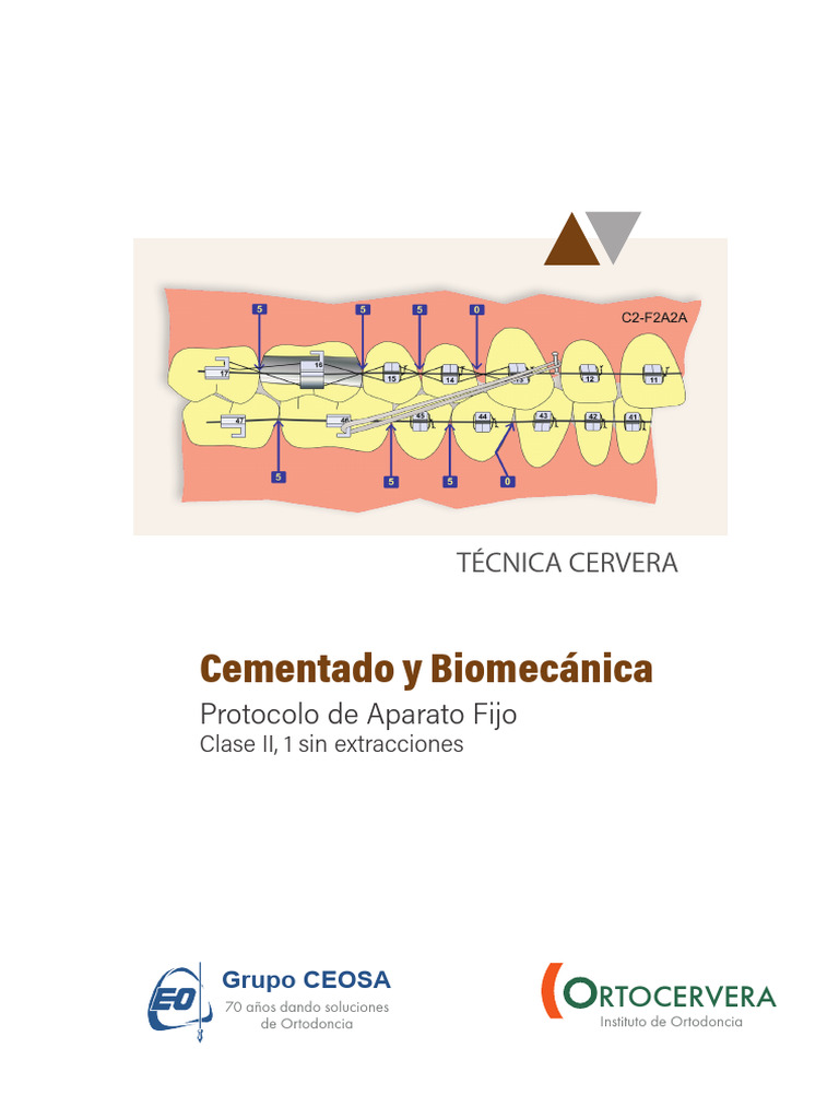 Protocolo de Aparato Fijo de Clase II 1 Sin Extracciones 10 Noviembre 2022 | PDF