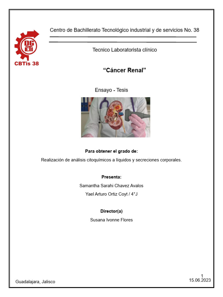 Cancer Renal Ensayo 4J Samantha Chavez Yael Ortiz | PDF | Fumar tabaco | Adicción