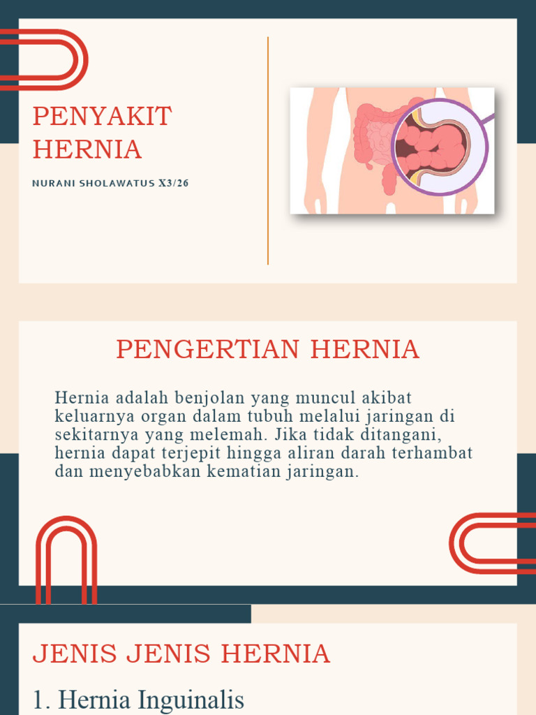 Penyakit Hernia | PDF