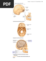 CT Brain Anatomy | PDF | Cerebral Cortex | Skull