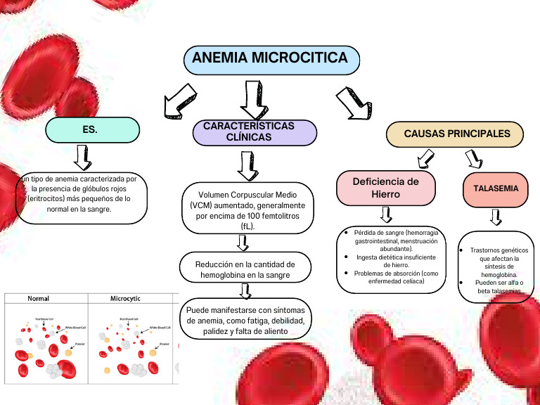 Anemia Microcitica | PDF