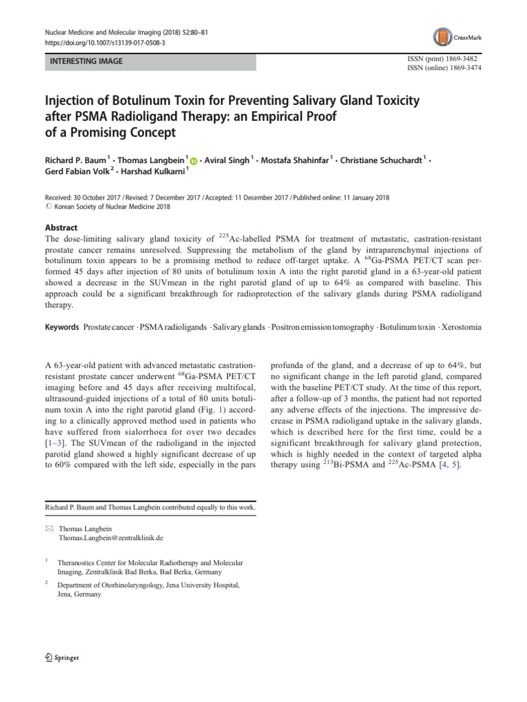 Cara Kerja Injection On Radioter | PDF | Science & Mathematics
