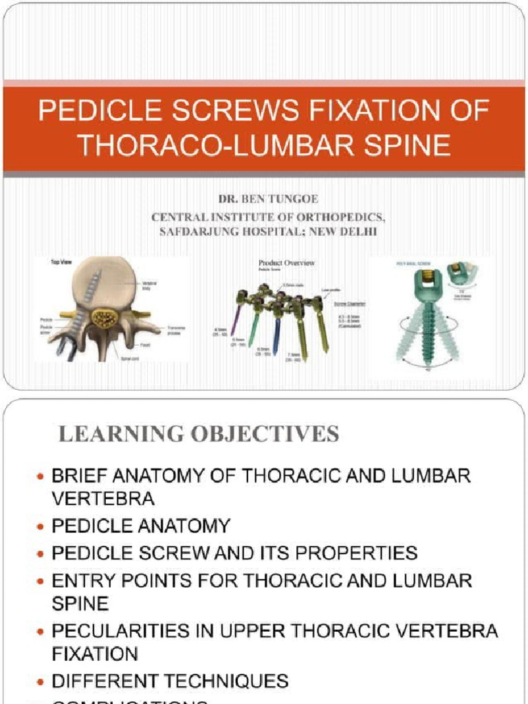 Pedicle Screws Fixation Thoraco Lumbal Spine | PDF