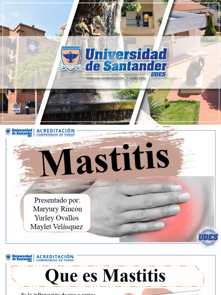 Mastitis | PDF | Pecho | Causas de la muerte