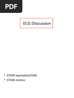 Ecg Interpretation J Point Stemi Criteria Equivalents and Others | PDF ...