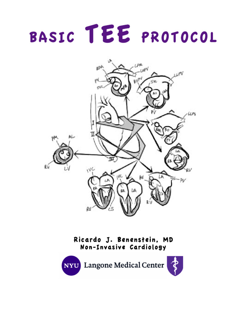 Comprehensive TEE Protocol Overview | PDF | Causes Of Death | Medical ...