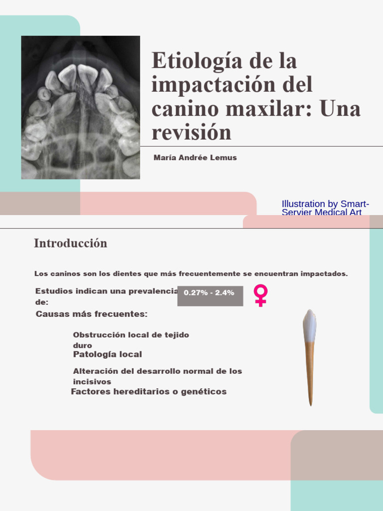 Etiología de La Impactación Del Canino Maxilar - Una Revisión | PDF ...