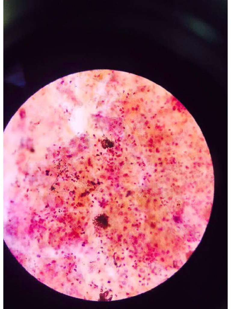 Histología Cérvix - LIBG 40x | PDF