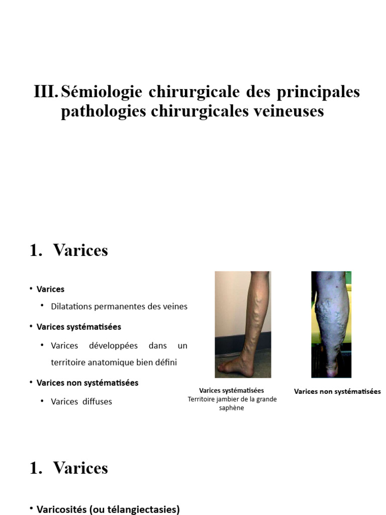6 Semiologie Chirurgicale Vasculaire Varices | PDF | Varices | Angiologie