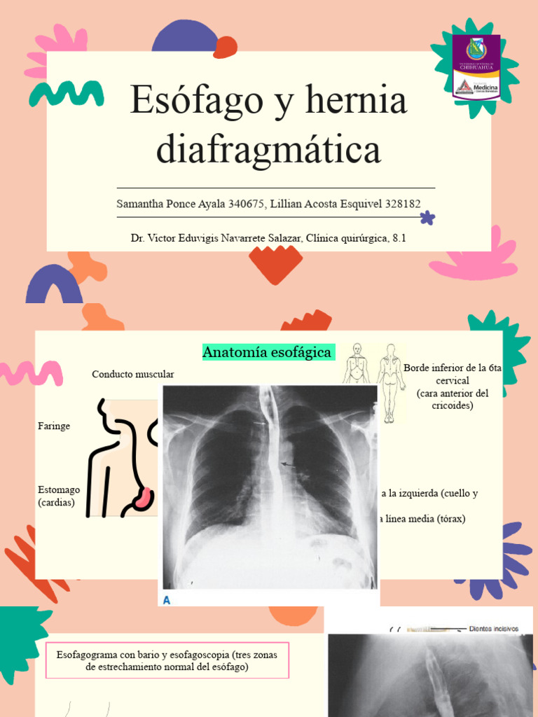 Esofago y hernias | PDF | Esófago | Sistema digestivo
