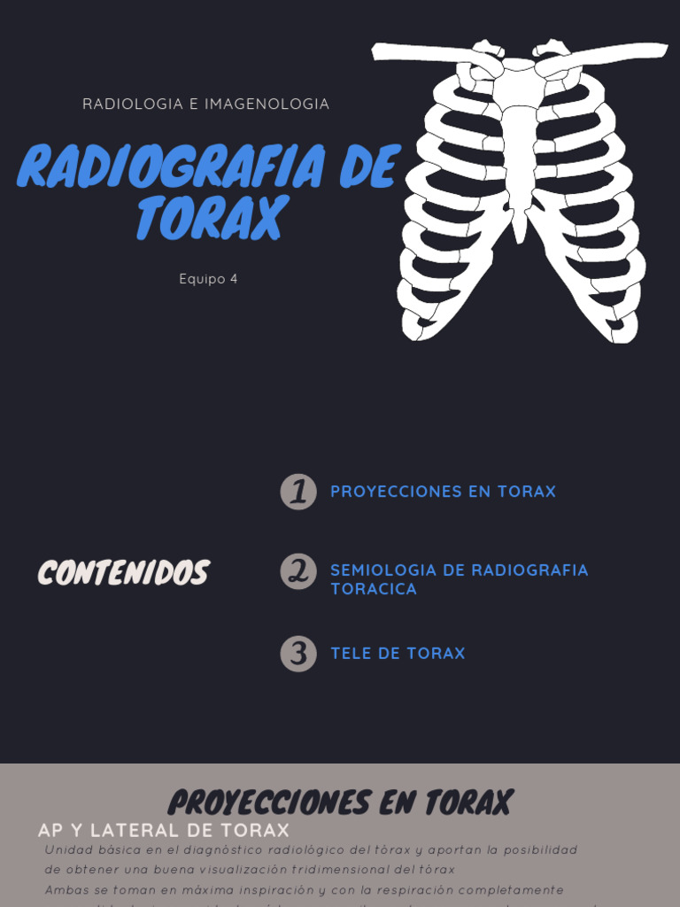 Radiografia de Torax | PDF | Pulmón | Tórax