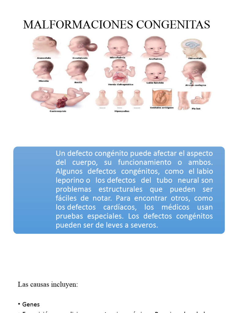 Malformaciones Congénitas y Tubo Neural | PDF | Anatomía | Enfermedades ...