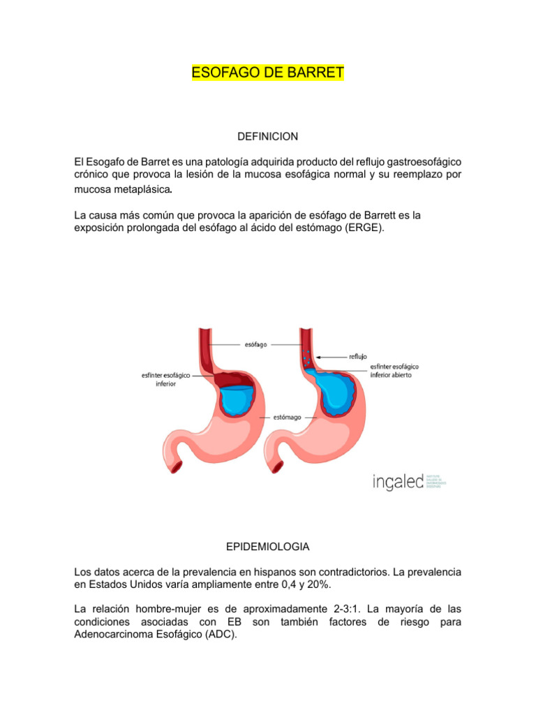 Esofago de Barret | PDF