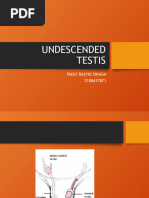Panduan Klinis Undescended Testis | PDF
