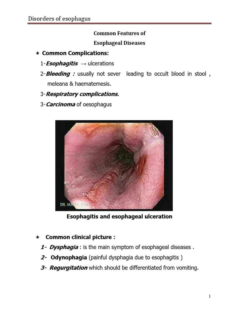 Common Features Of Diseases Of Esophagus Pdf Esophagus Vomiting
