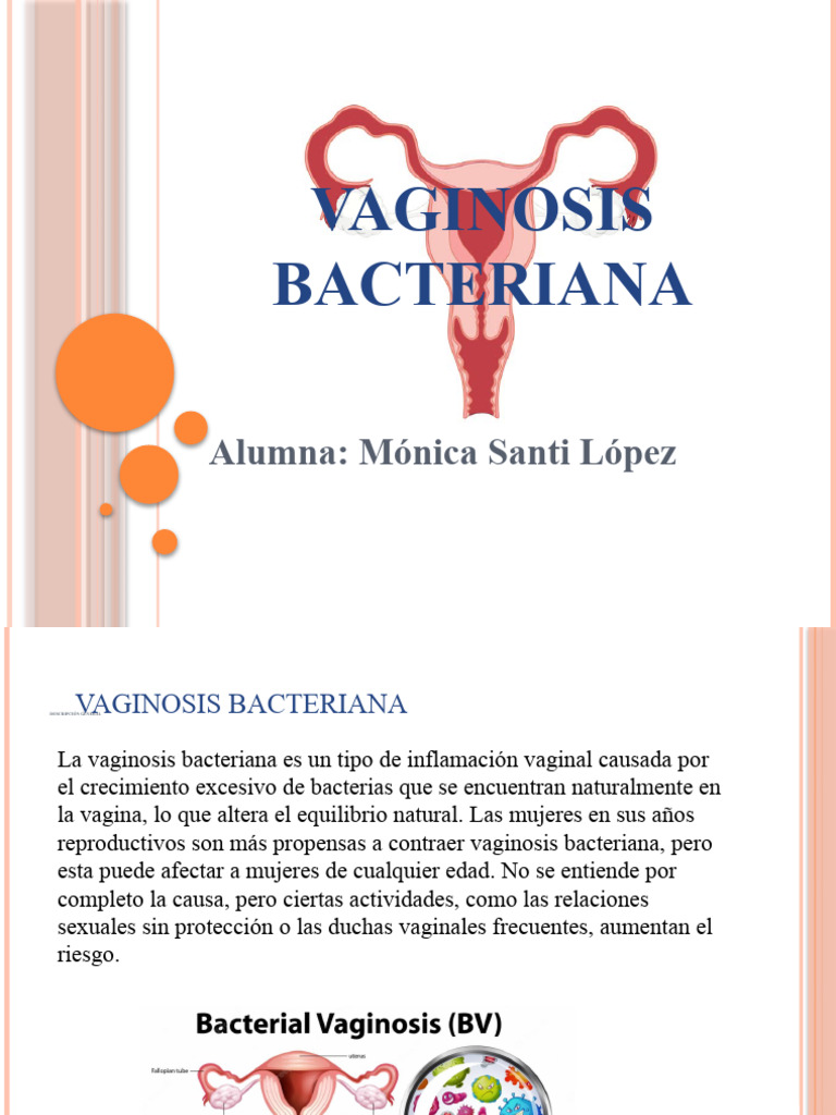 Vaginosis ...... | PDF | Vagina | Infección transmitida sexualmente
