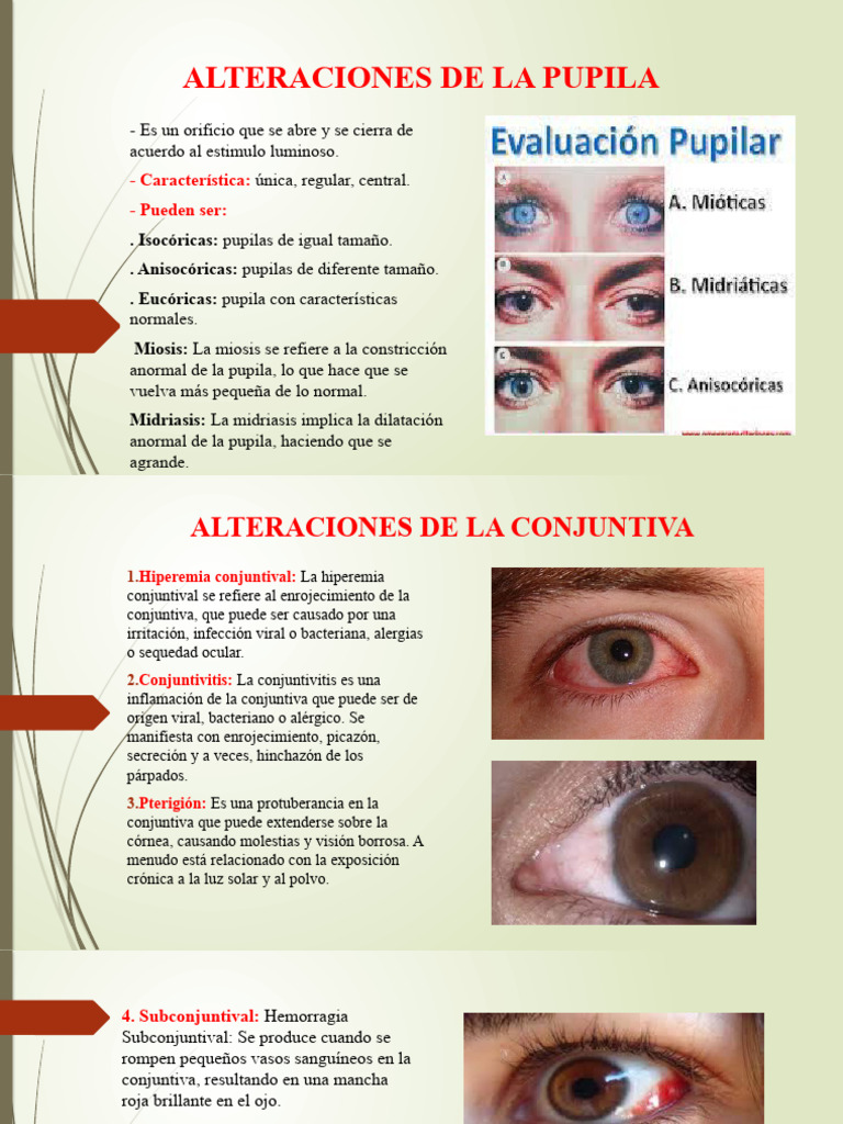 Tipos y Alteraciones de Pupilas | PDF | Alergia | Epidemiología