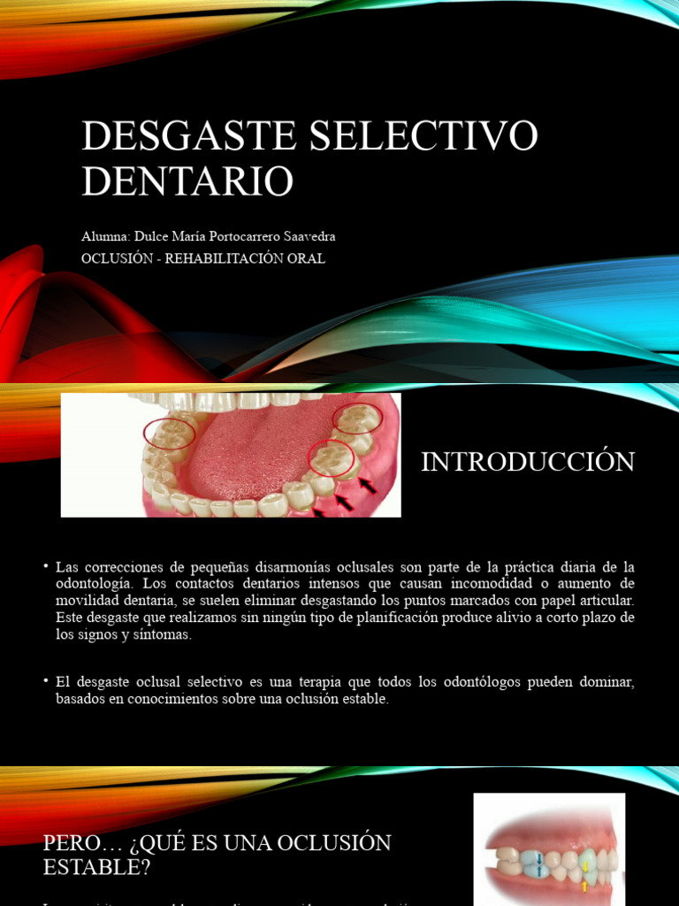Desgaste Selectivo Dentario Oclusion | PDF | Dentadura postiza ...